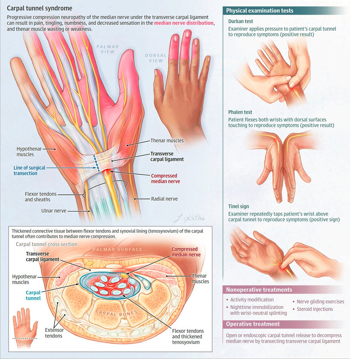 Physio Meets Science On Twitter Overview Of Pathophysiology