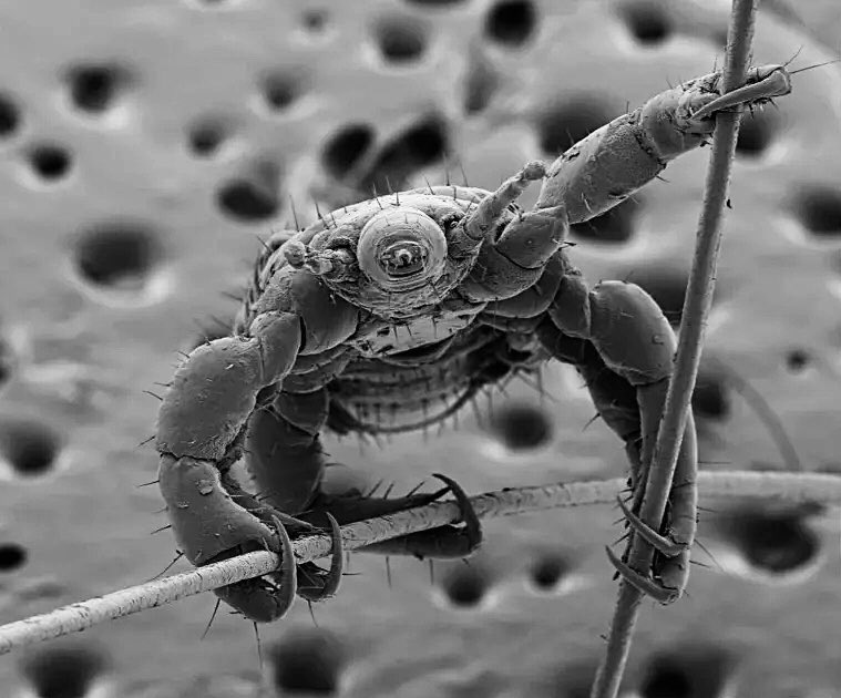 Lice Under A Microscope