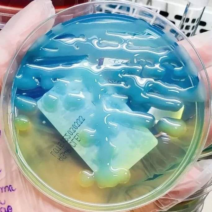 Klebsiella Pneumoniae On Cled Agar