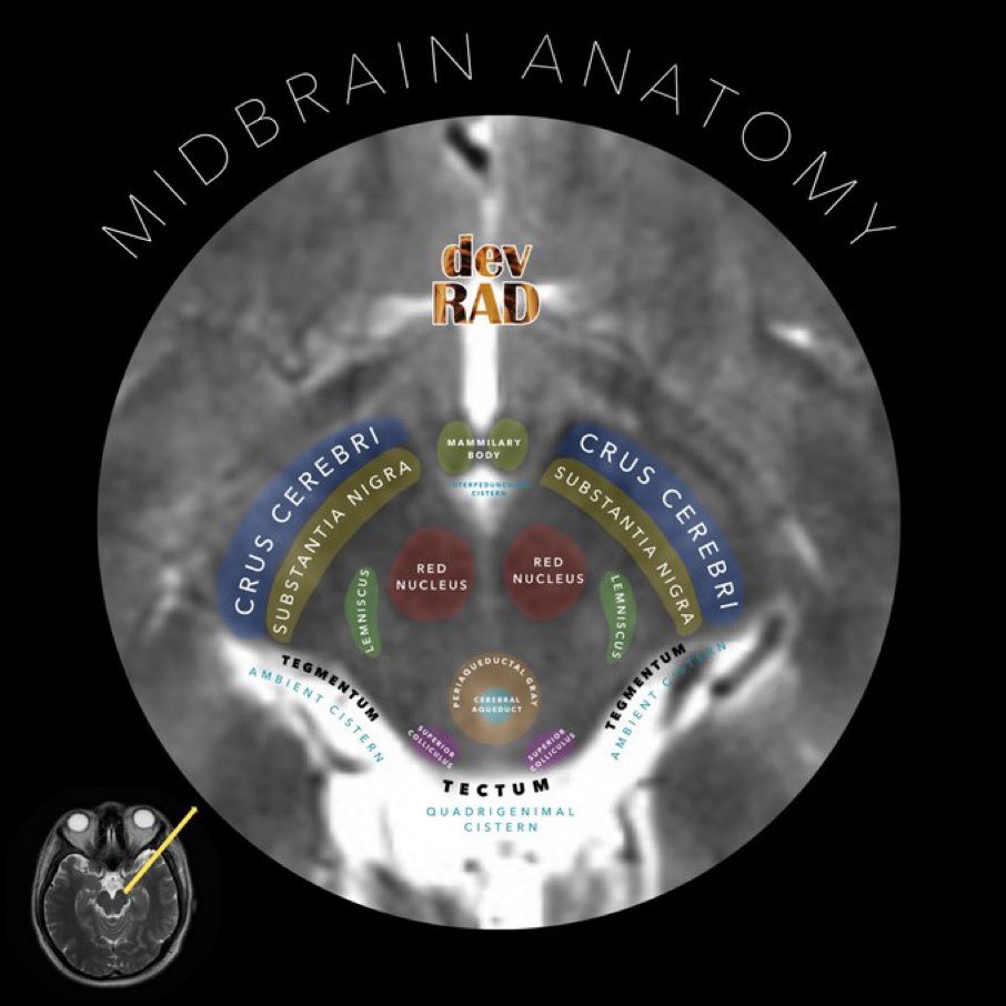 Anatomy Midbrain Mri at Dakota Frith blog