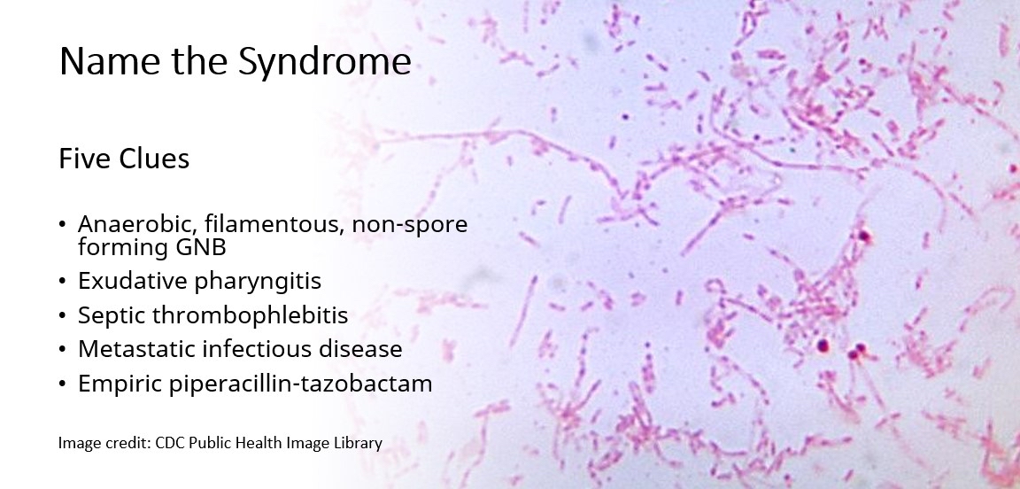 Weekend Digest Name the Syndrome Five Clues 1. Anaerobic nonmotile ...