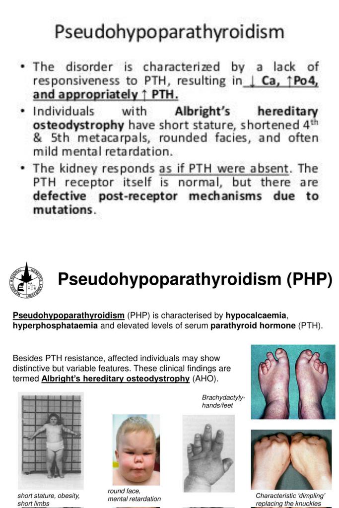 Albright Hereditary Osteodystrophy