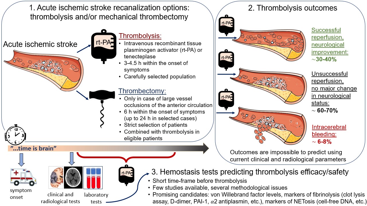 Ischemic Stroke Pathophysiology
