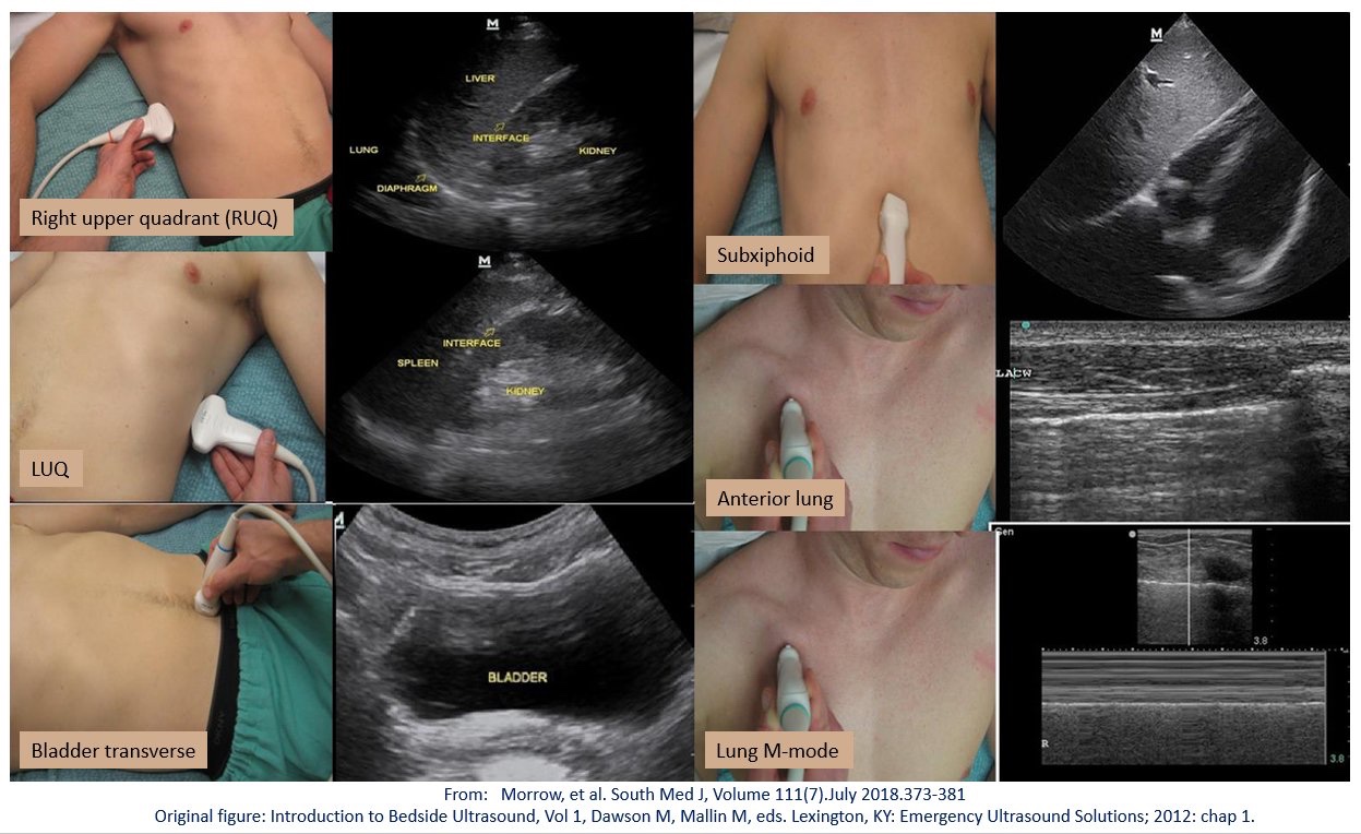 Nephropocus On Twitter 7 Transducer Position And Normal Images