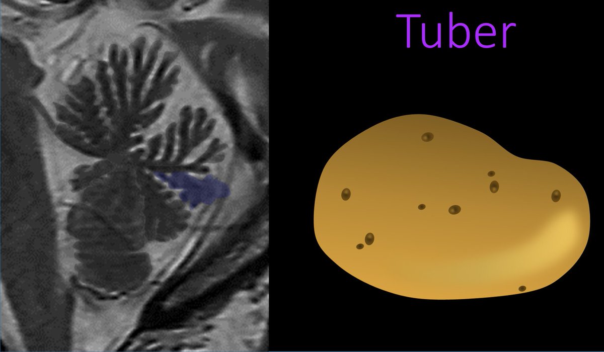 1/Is remembering cerebellar anatomy making you dizzy? Need help telling ...