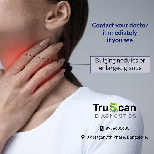 DrJlopezmd Swollen Lymph Nodes Indicate Changes In The Lymphatic System ...