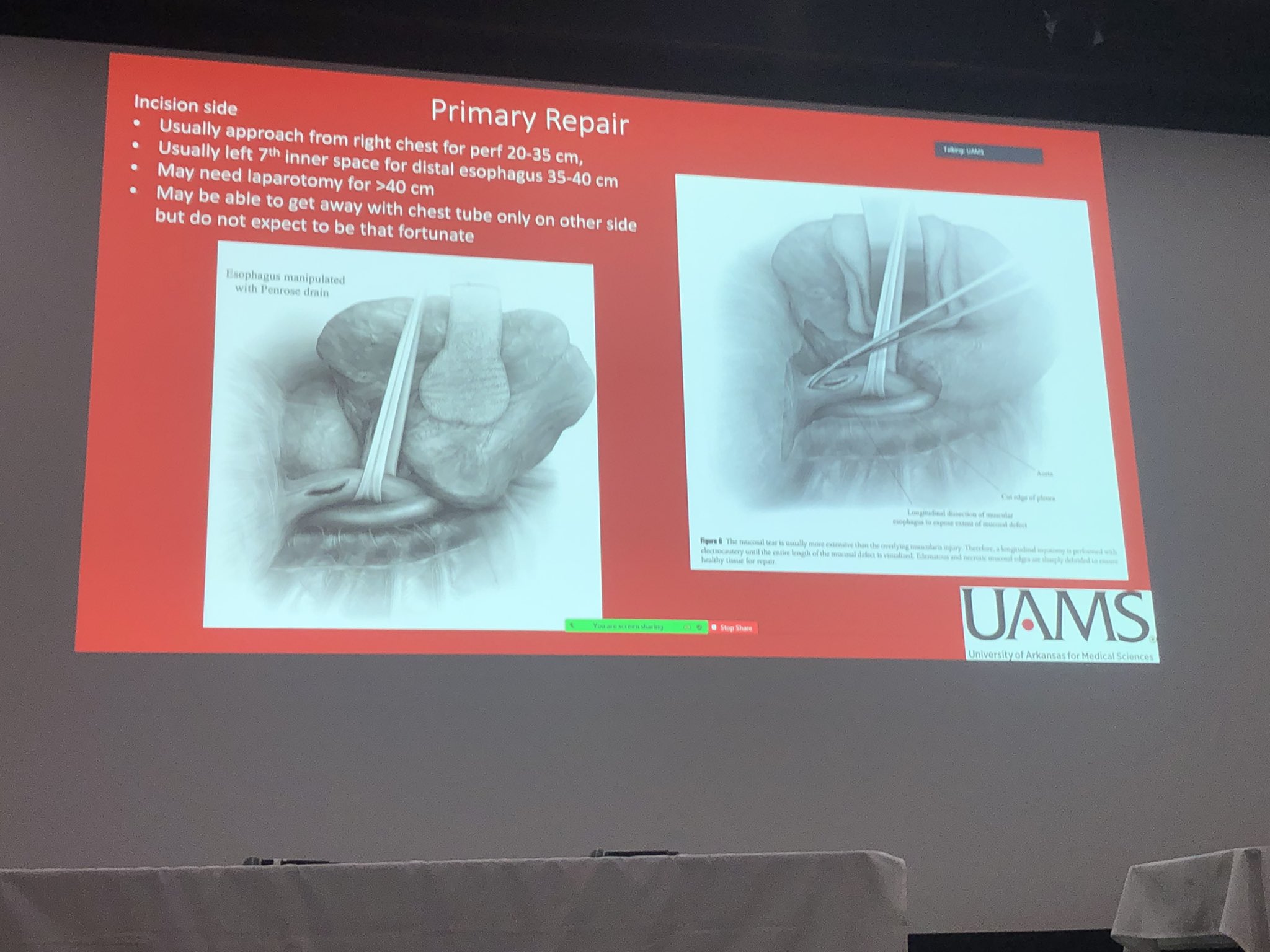 UAMS Vascular & Endovascular Surgery on Twitter: UAMS Vascular & Endovascular Surgery on Twitter: