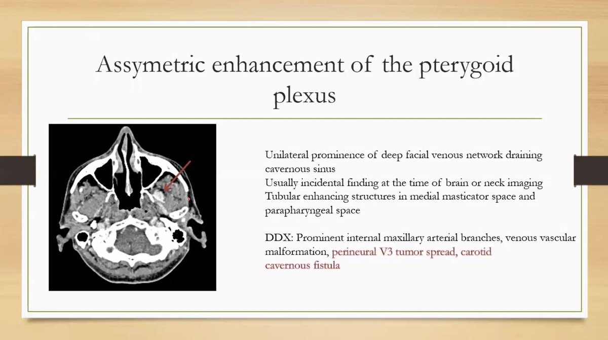 Pterygoid Plexus