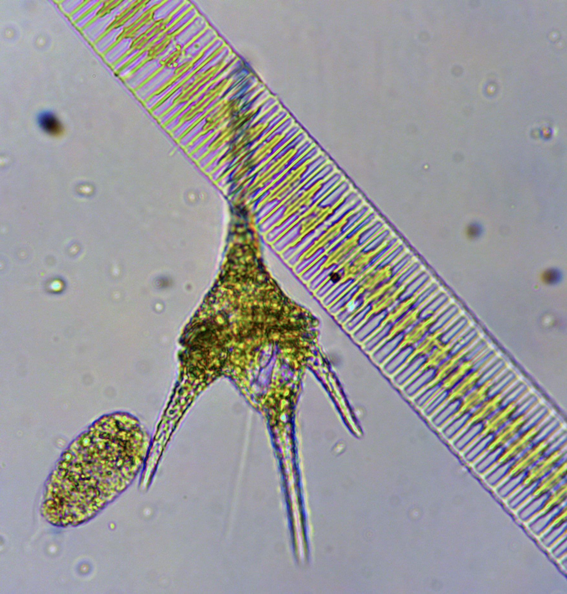 Ceratium Under Microscope