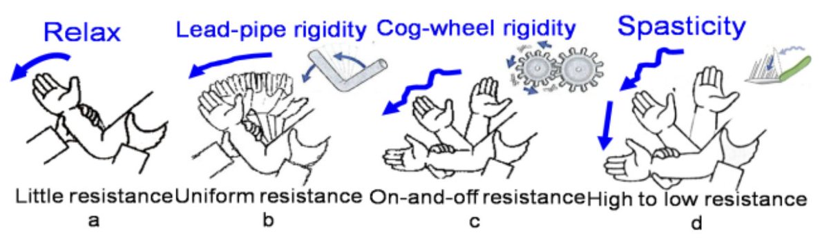 Lead Pipe Rigidity EPOS™