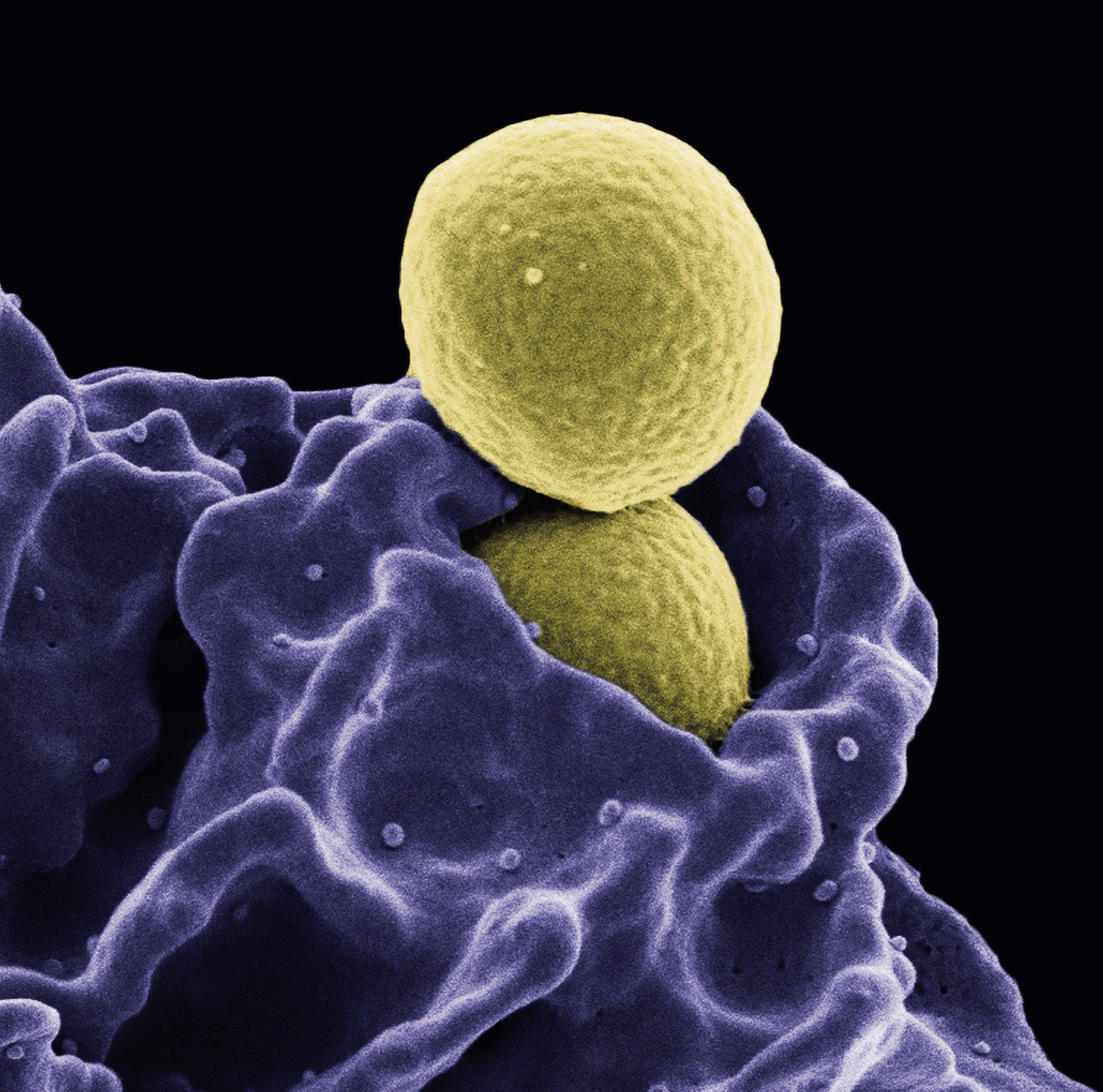 B Lymphocytes Under A Microscope