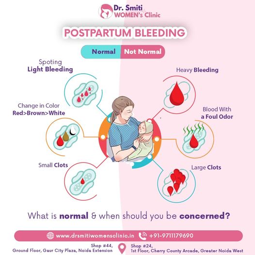 Postpartum Bleeding