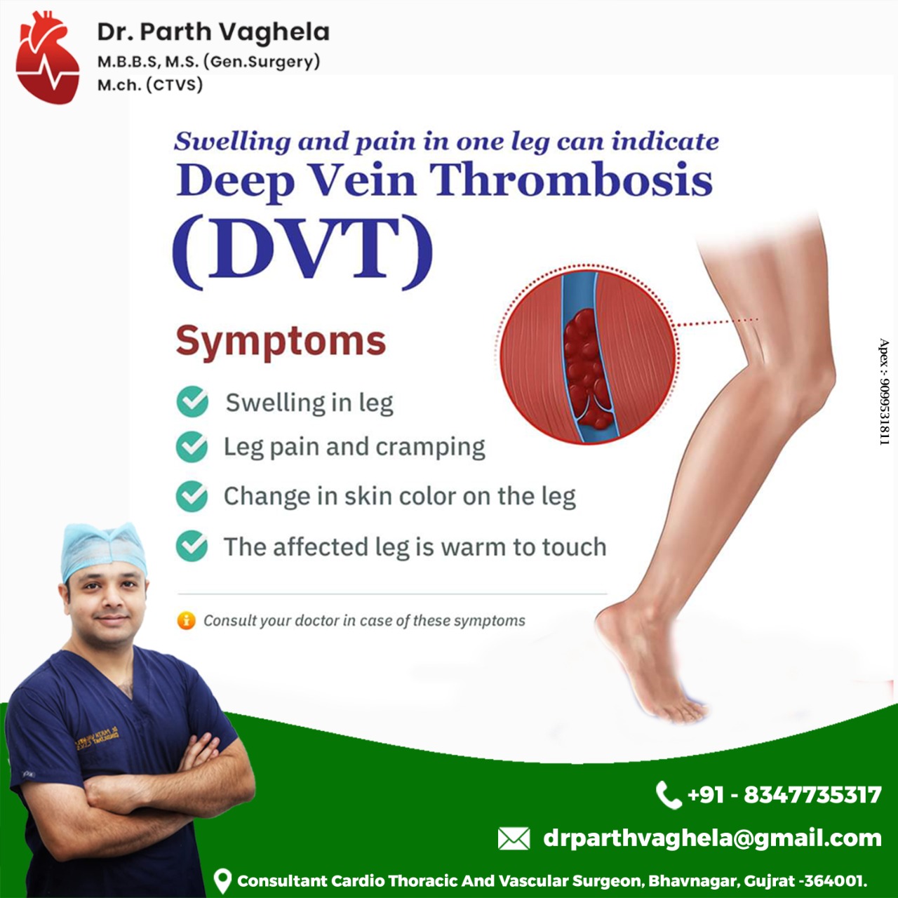 Dvt In Thigh