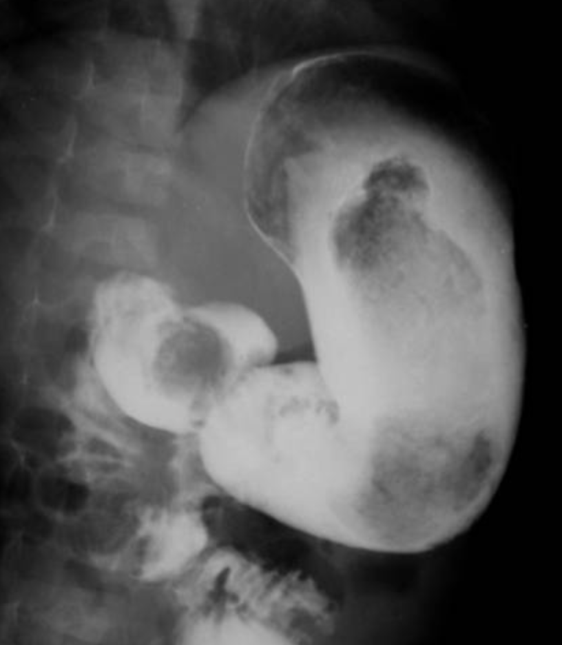 Radrounds Radiology Network Radrounds Twitter