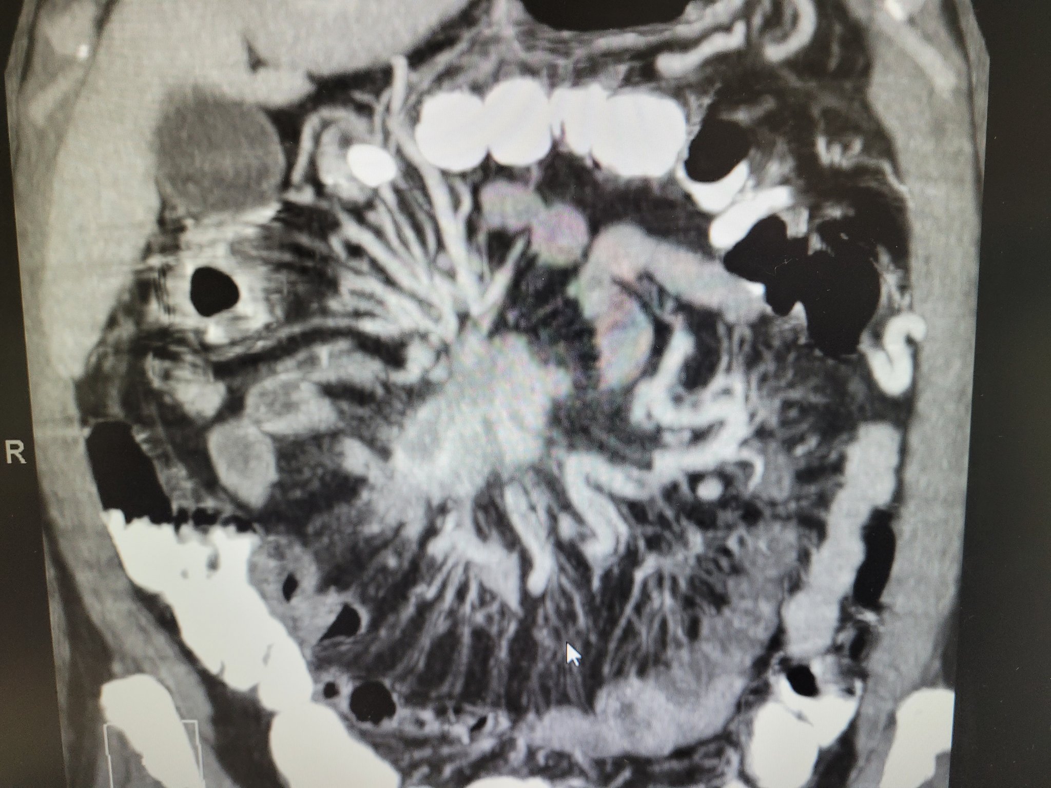 Radrounds Radiology Network Radrounds Twitter