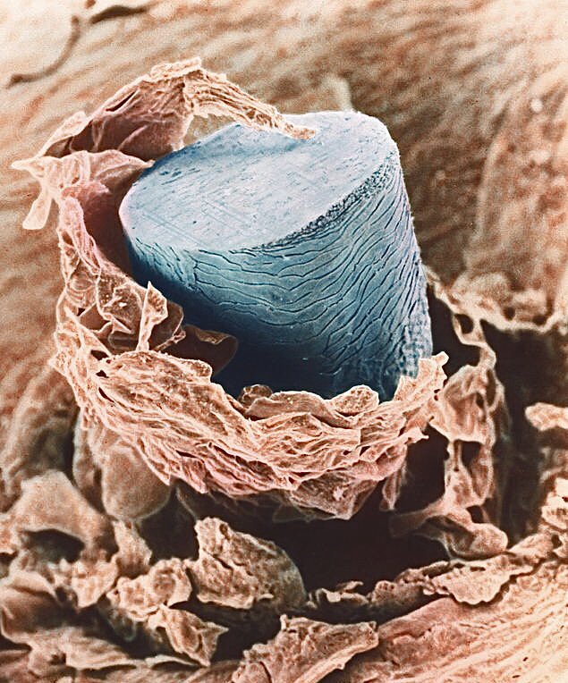 Human Hair Under Electron Microscope