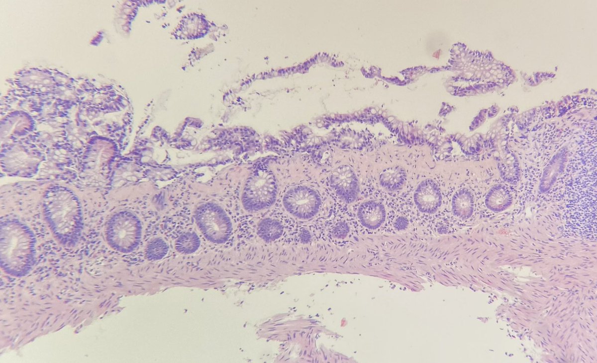 Jerad Gardner, MD on Twitter: Jerad Gardner, MD on Twitter: