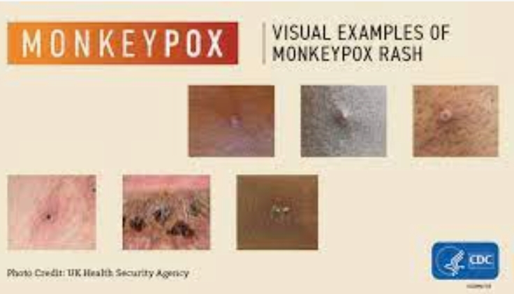 Bruce Adams on Twitter: "More from the purveyor of predictive programming. Now Monkey Pox?"