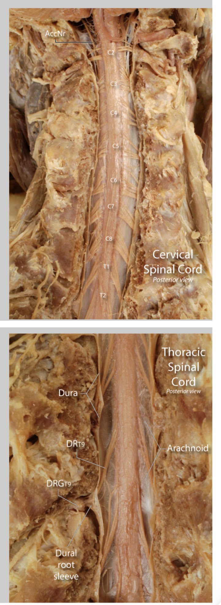 Cadaver Spinal Cord