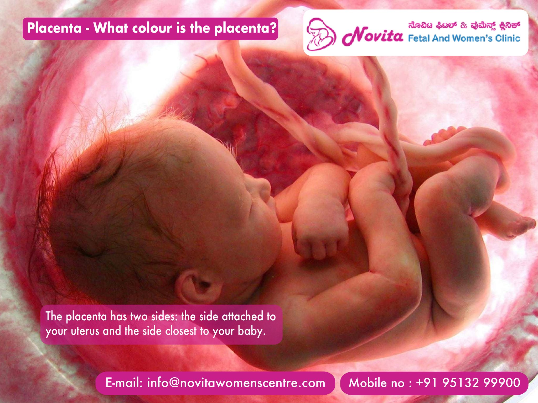 Novita Fetal and Women's Clinic on Twitter: "Placenta - What colour is the placenta? The ...