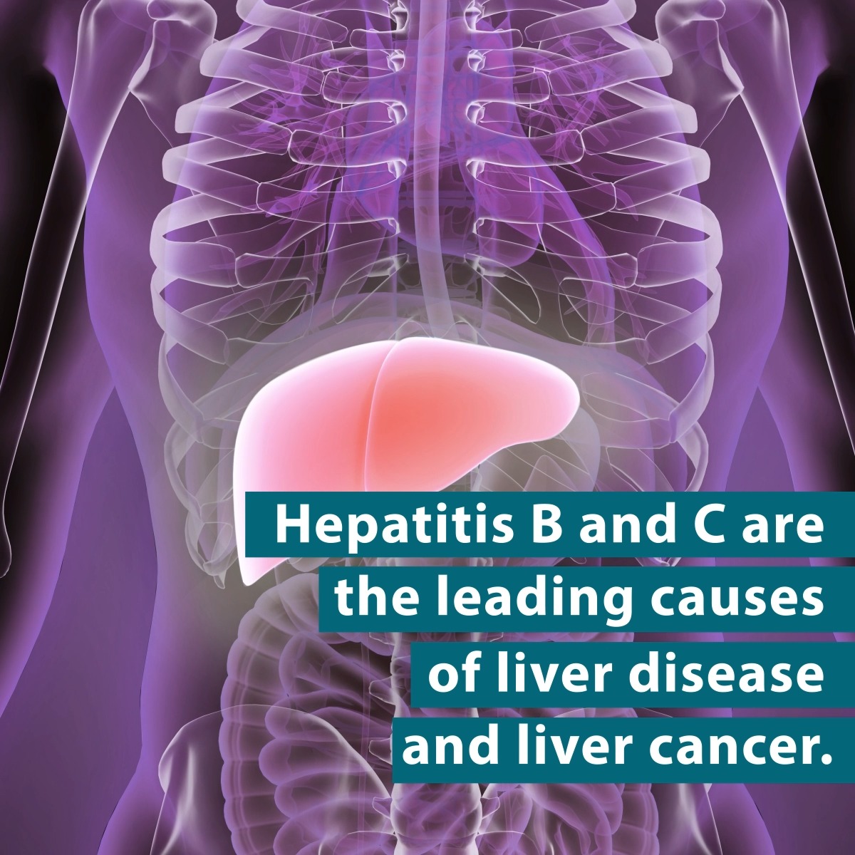 Hepatitis B Liver
