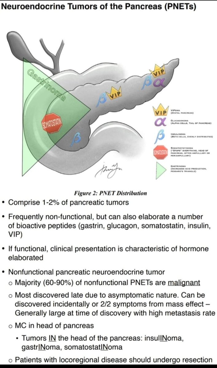 Gastrinoma Triangle