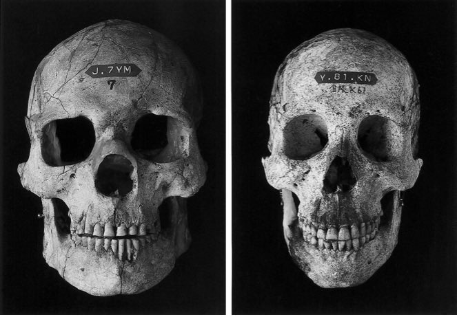 Mongoloid Skull Side