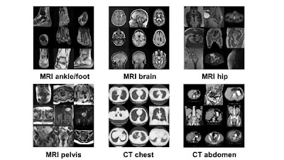 Radiology: Artificial Intelligence on Twitter: "RadImageNet: An Open Radiologic Deep Learning ...