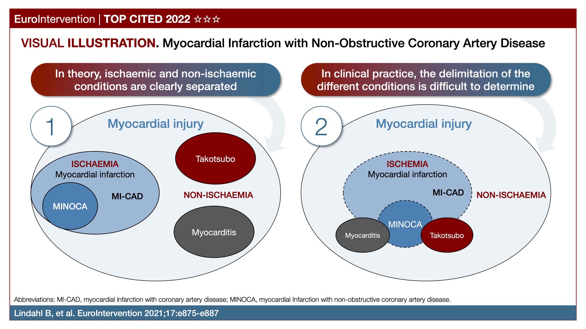 Davide Capodanno on Twitter: "This review summarises the current knowledge on myocardial ...