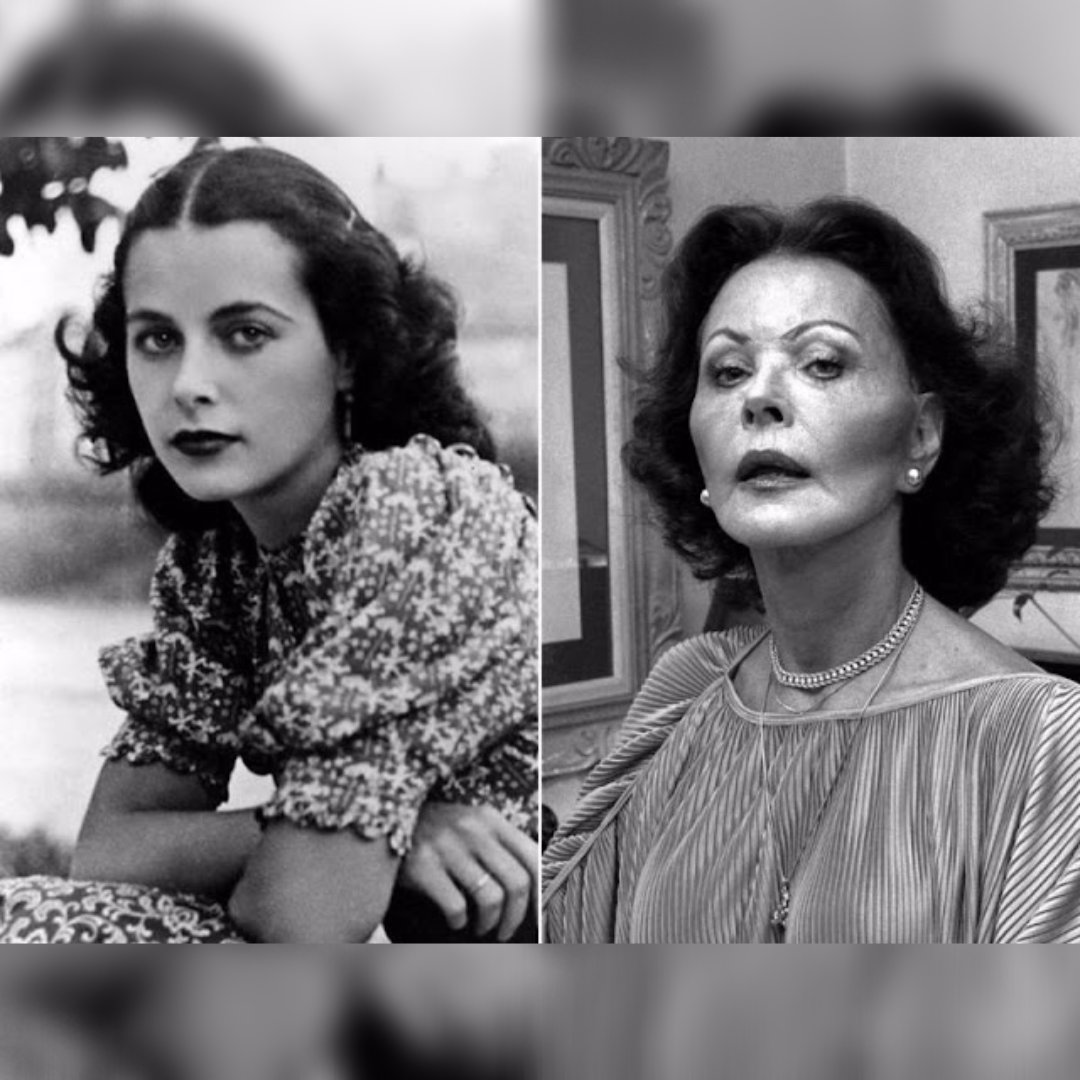 Hedy Lamarr Plastic Surgery