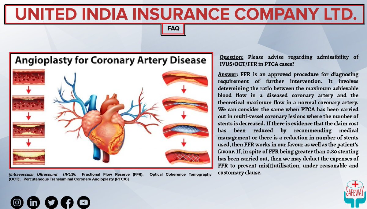 Percutaneous Transluminal Coronary Angioplasty (ptca)