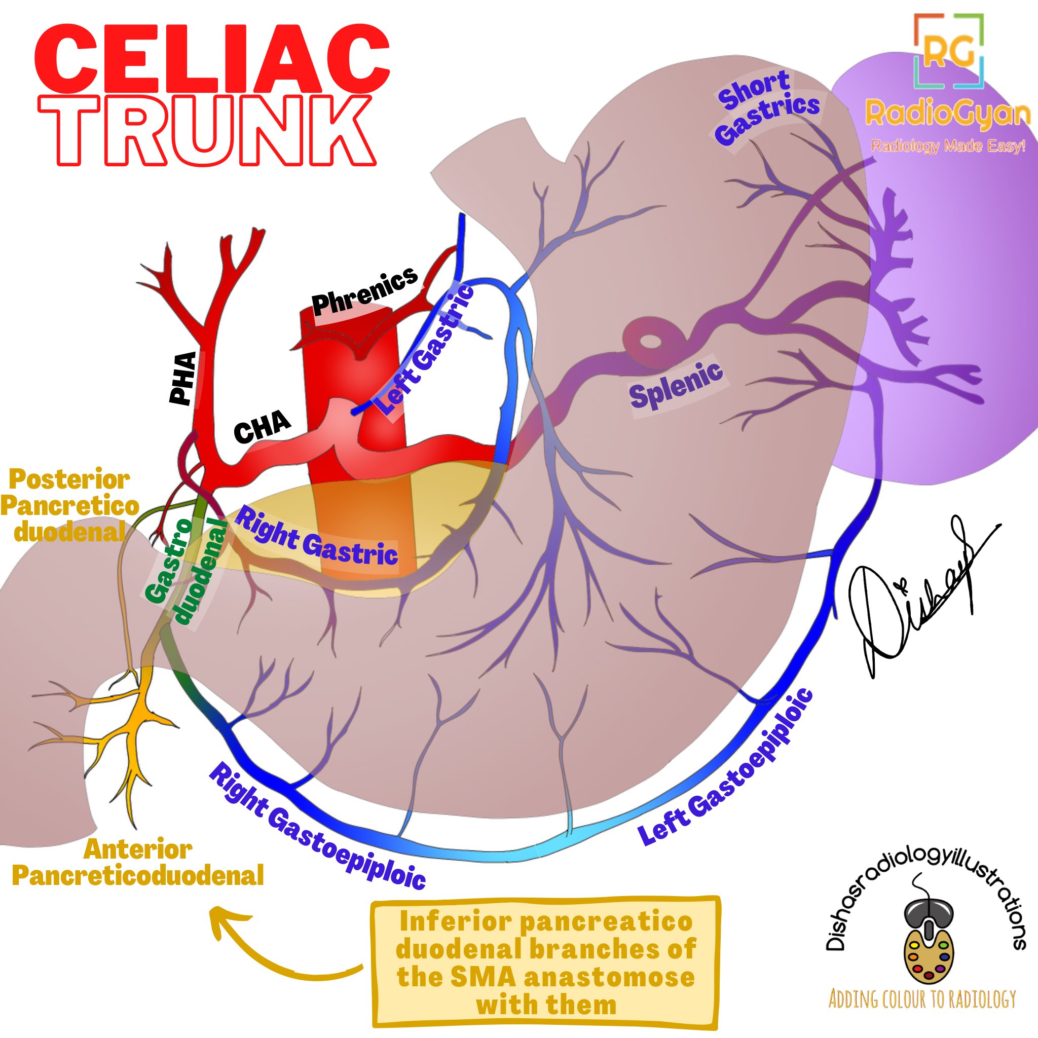 Celiac Trunk Multiple Rare Anatomical Variation Of Celiac Trunk,