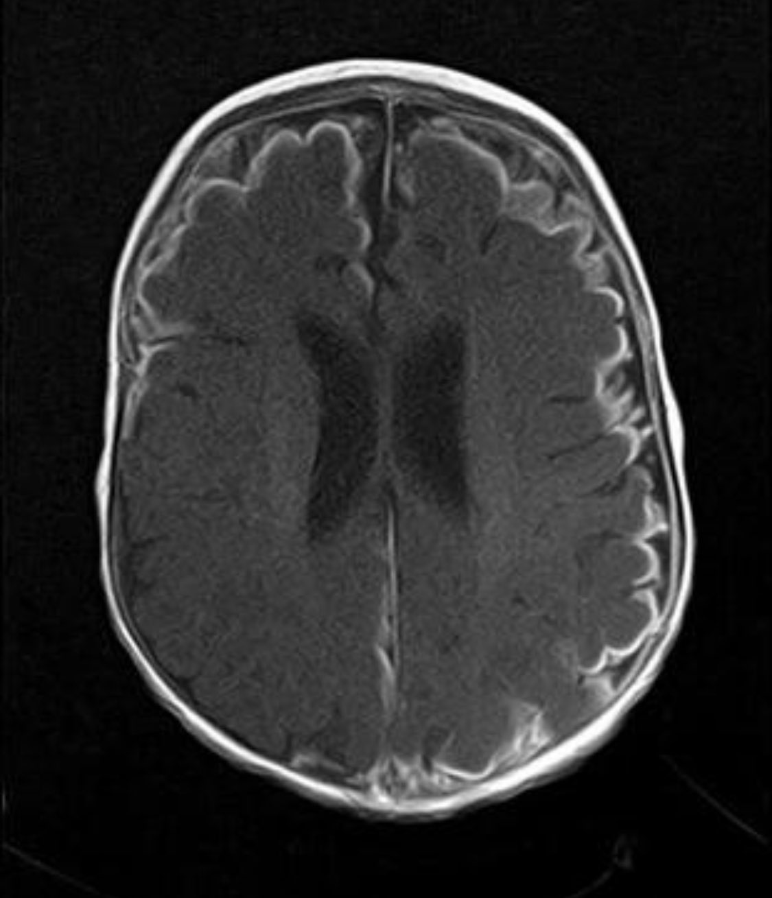 Radrounds Radiology Network Radrounds Twitter