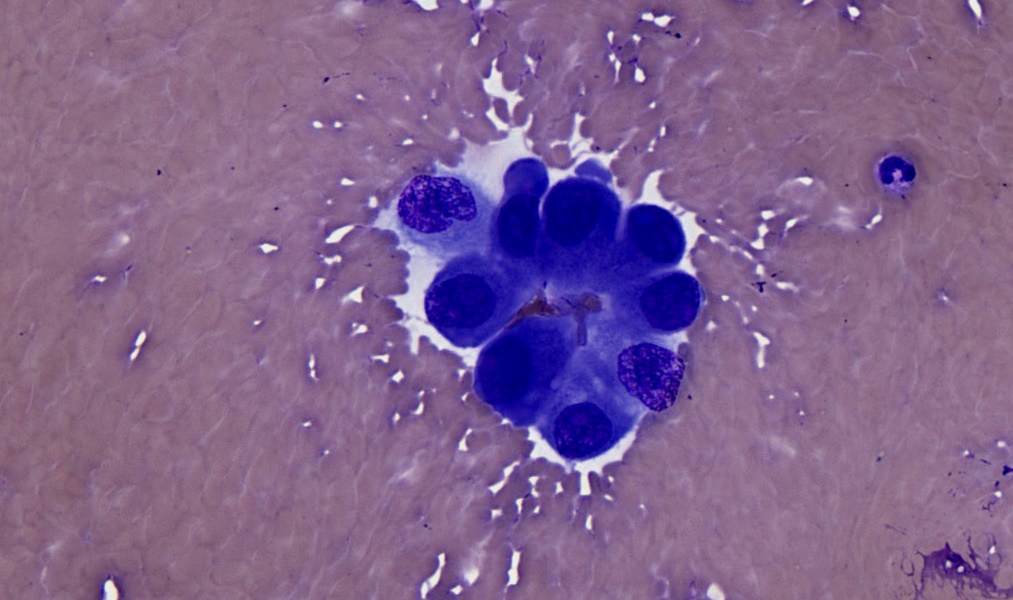 Knee joint, adult #cytopath #BSTpath #pathresidents #PathTwitter ...