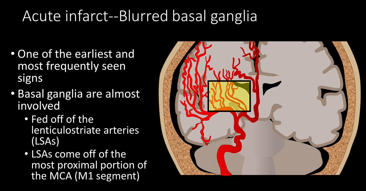 1/Time is brain! So you don’t have time to struggle w/that "stroke ...