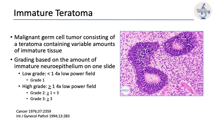 Teratoma Histology