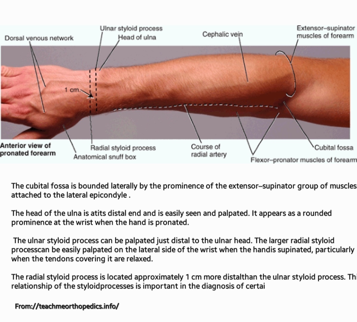 Ulnar Styloid Process Palpation I) Examination Of The Wrist—soft