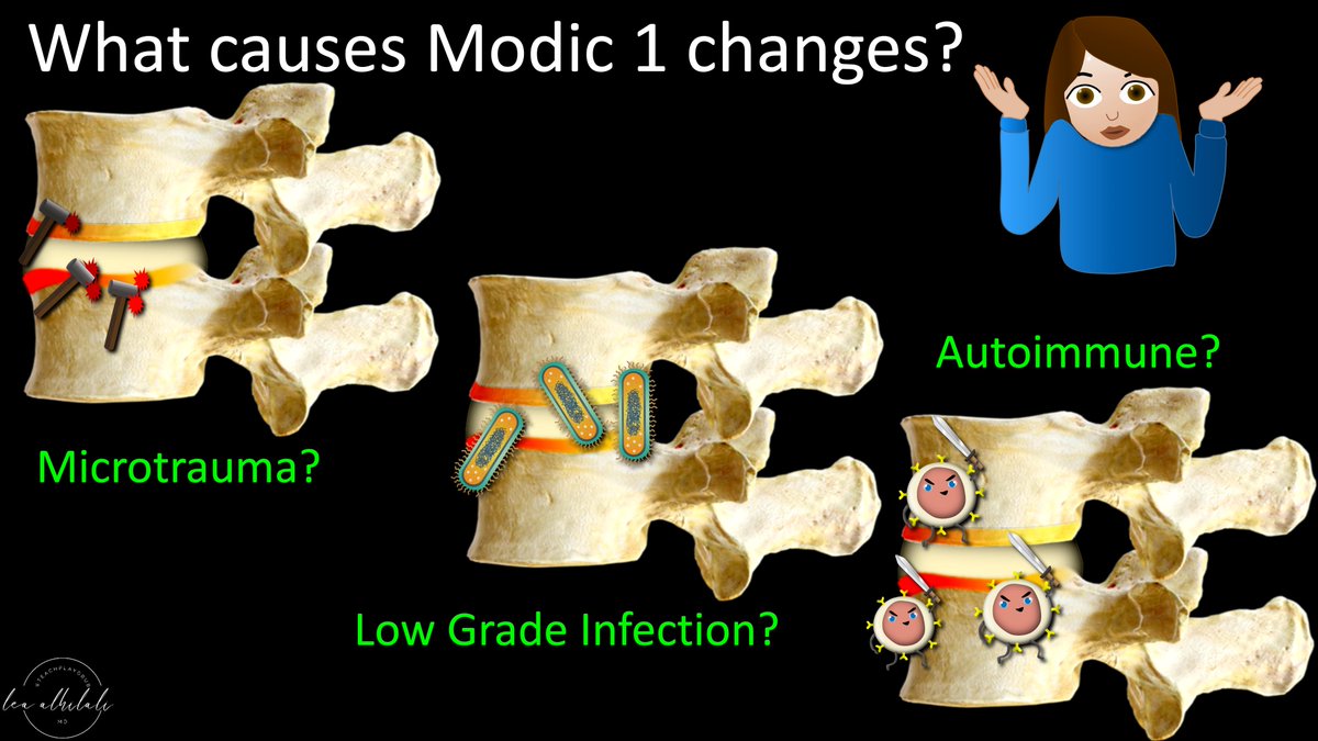 1/Do you feel there’s a back-log of findings in a spine MRI report ...