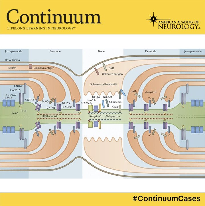 A 24 year old man had progressive painless weakness and numbness over 4 ...