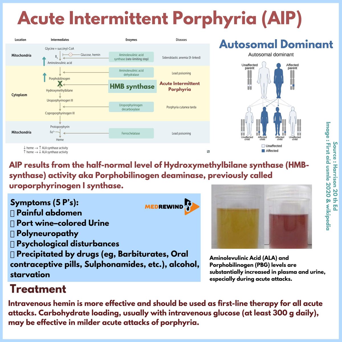 Porphyria Urine In Sunlight
