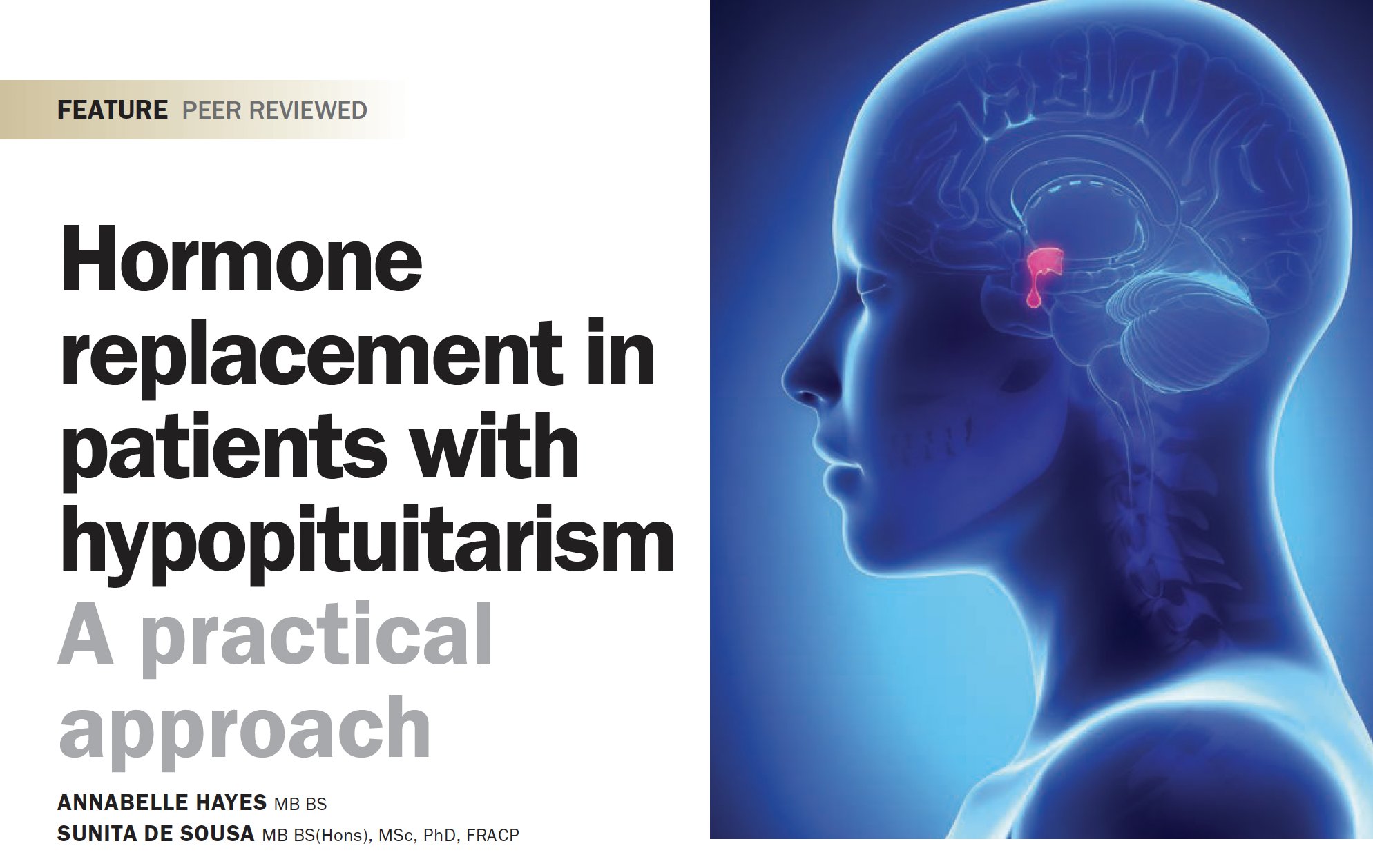 Hypopituitarism Patients
