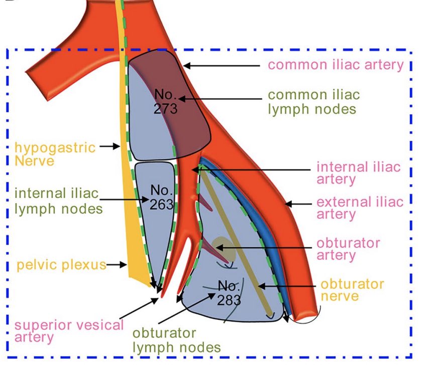 🚨 🚨 🚨 🚨 🚨 🚨 Lateral pelvic lymph nodes (LPLN) in #RectalCancer (RCa ...