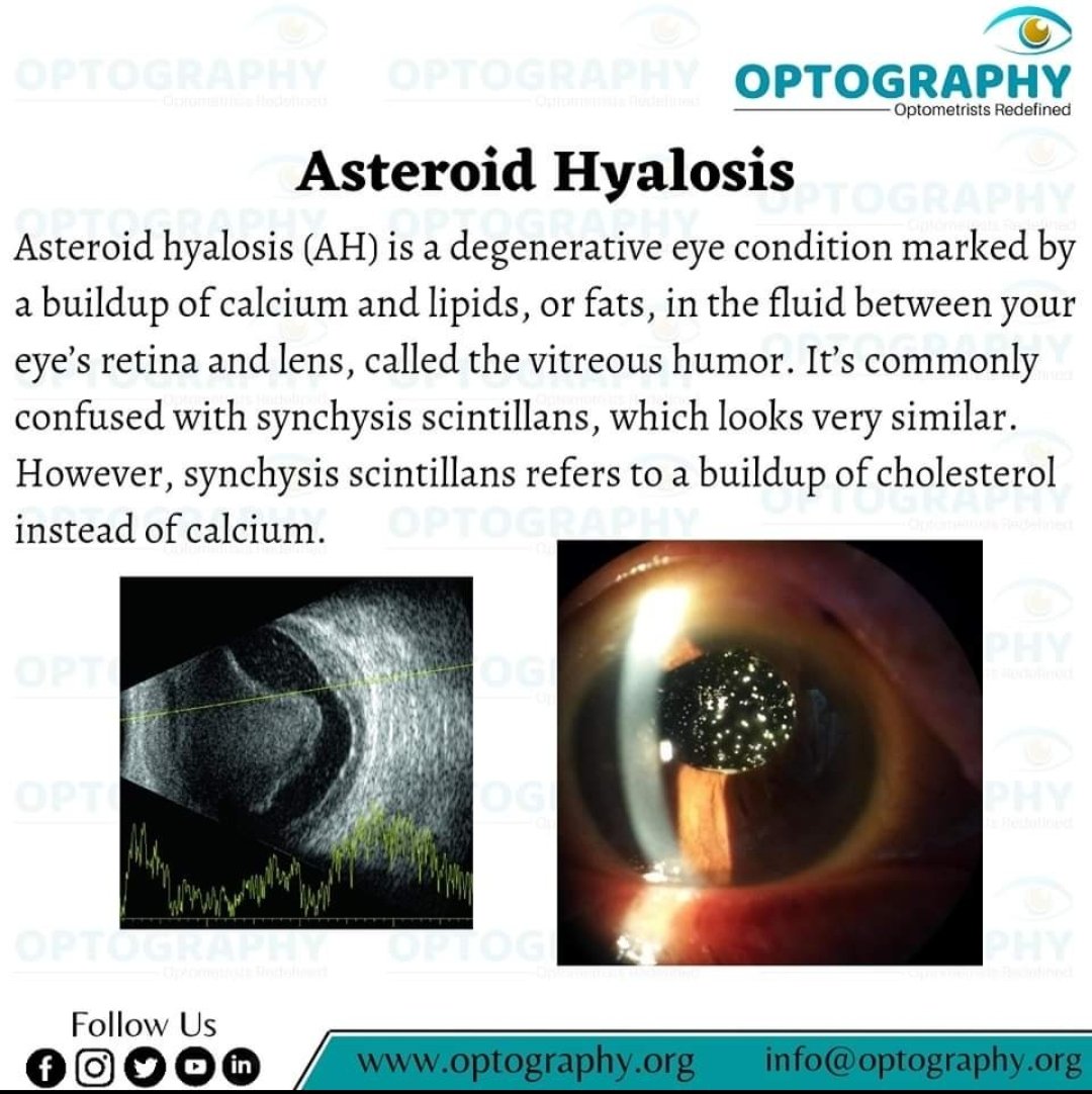 Asteroid Eye Disease
