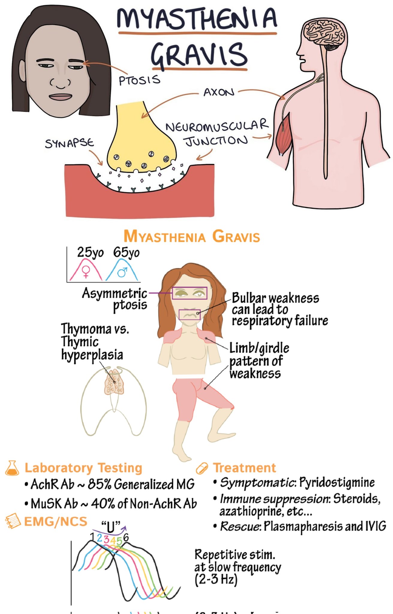 Plasmapheresis Myasthenia Gravis