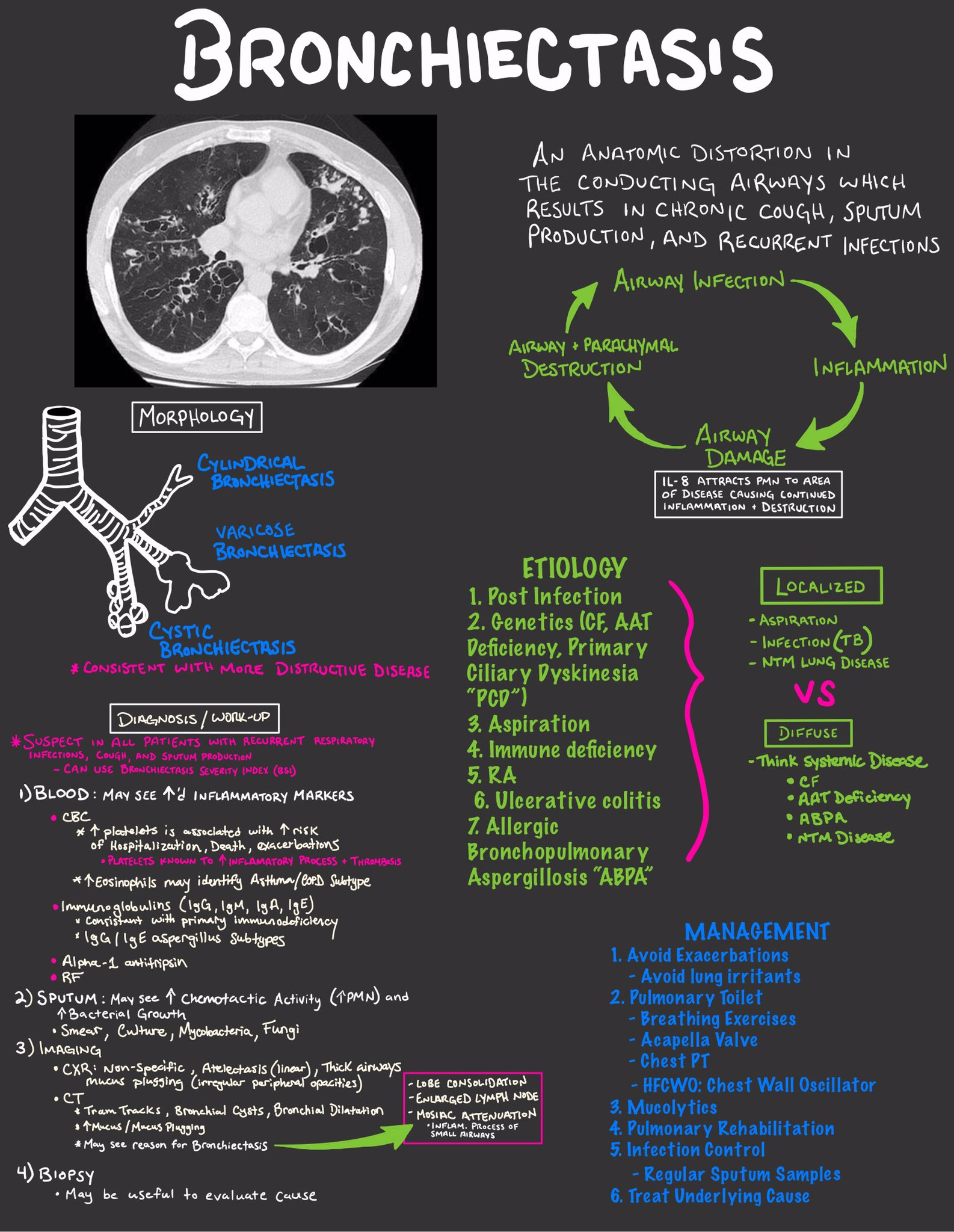 Brown Journal of Hospital Medicine on Twitter: "Bronchiectasis @CritCultivation #BJHM #MedEd # ...