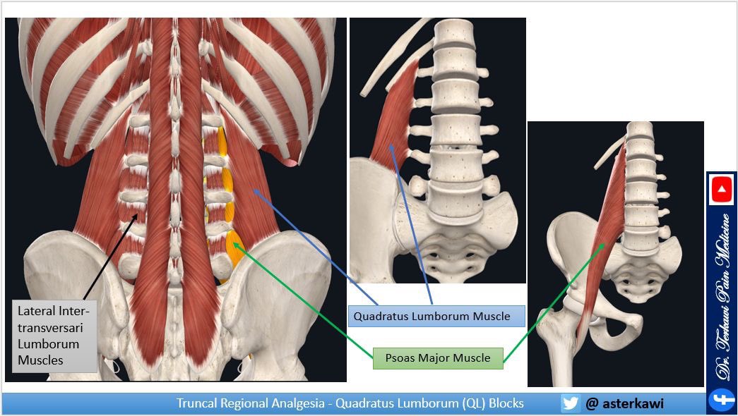 Quadratus Lumborum And Psoas Low Back Pain Treatments | Manchester