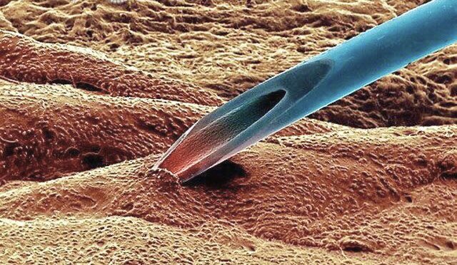Microscopic Images On Twitter Needle Puncturing Human Skin Under An
