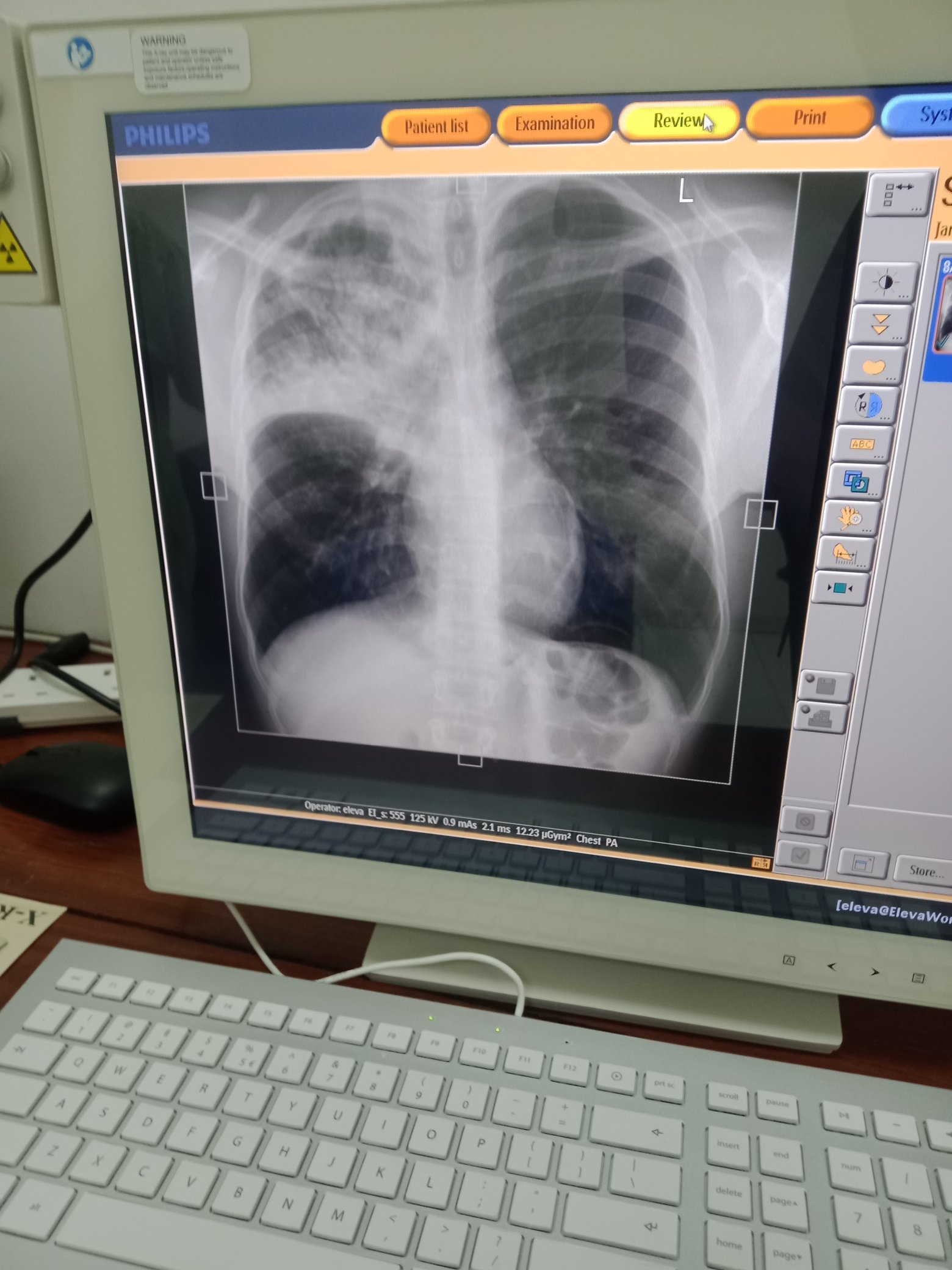 theRadiologist on Twitter: "Pelvic X-Ray Anatomy https://t.co/QGlW7AvJks" / Twitter