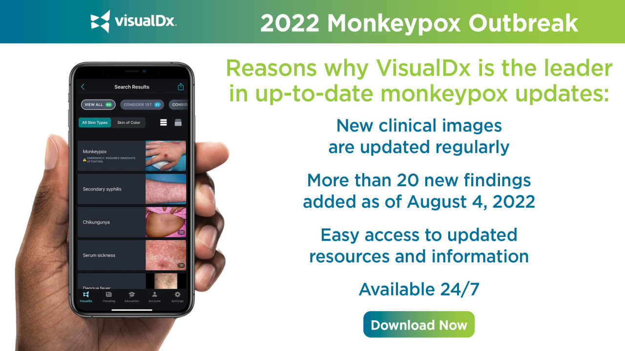 VisualDx on Twitter: "VisualDx can be your guide to understanding #Monkeypox! Through the power ...