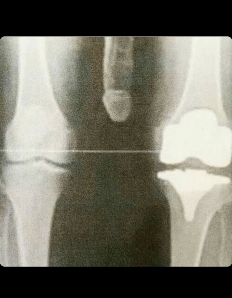 Memes Con Radiografias Excelente Inicio De Semana 😁 #Humor